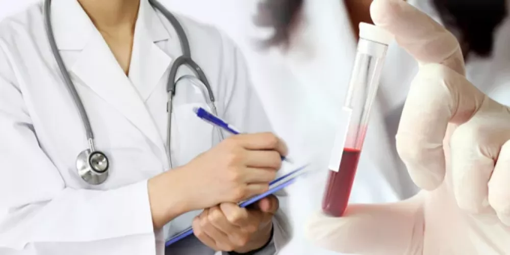 أنزيم ناقلة الغاما غلوتاميل | Gamma-Glutamyl Transpeptidase Test ...